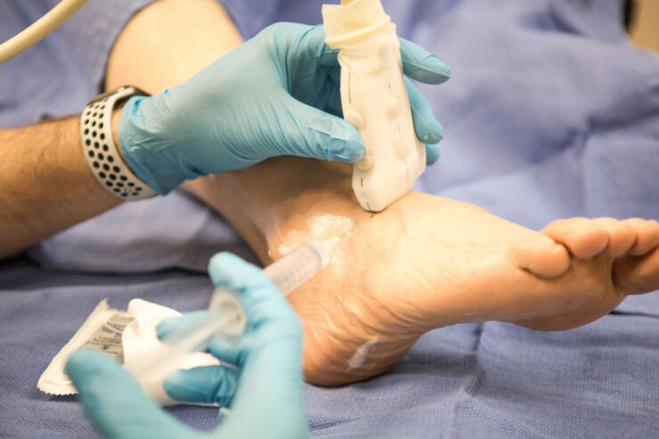 What Is The Success Rate Of Prolotherapy? - Nhlink.net